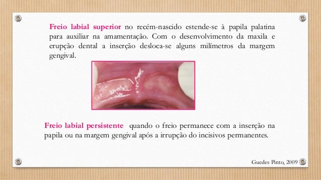 Odontologia para bebês