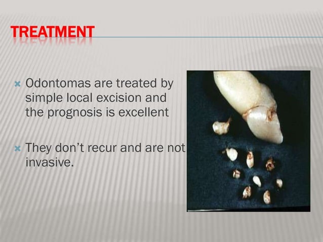 Odontoma (Doctor Faris Alabeedi MSc, MMedSc, PgDip, BDS.) | PPTX | Dental Health | Diseases and ...