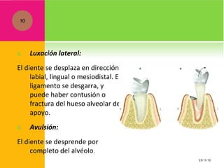 Odontopediatria traumatismo en piezas primarias | PPT
