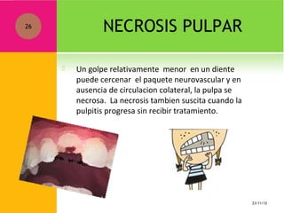 Odontopediatria traumatismo en piezas primarias | PPT
