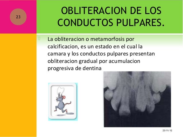 Odontopediatria traumatismo en piezas primarias