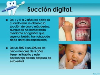 Odontopediatría para padres | PPSX