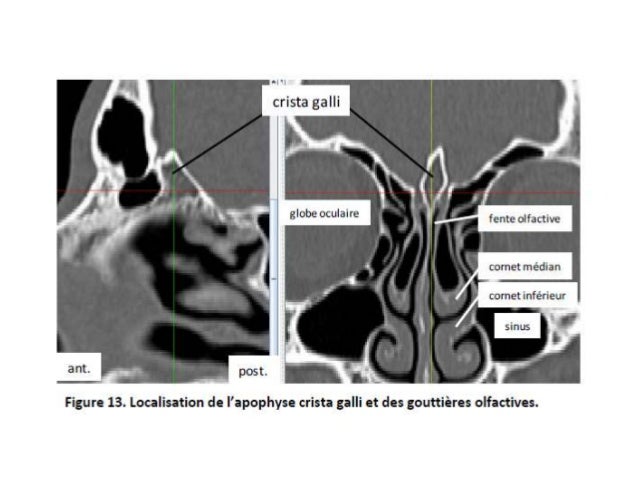 Odorat cours septembre 2017t