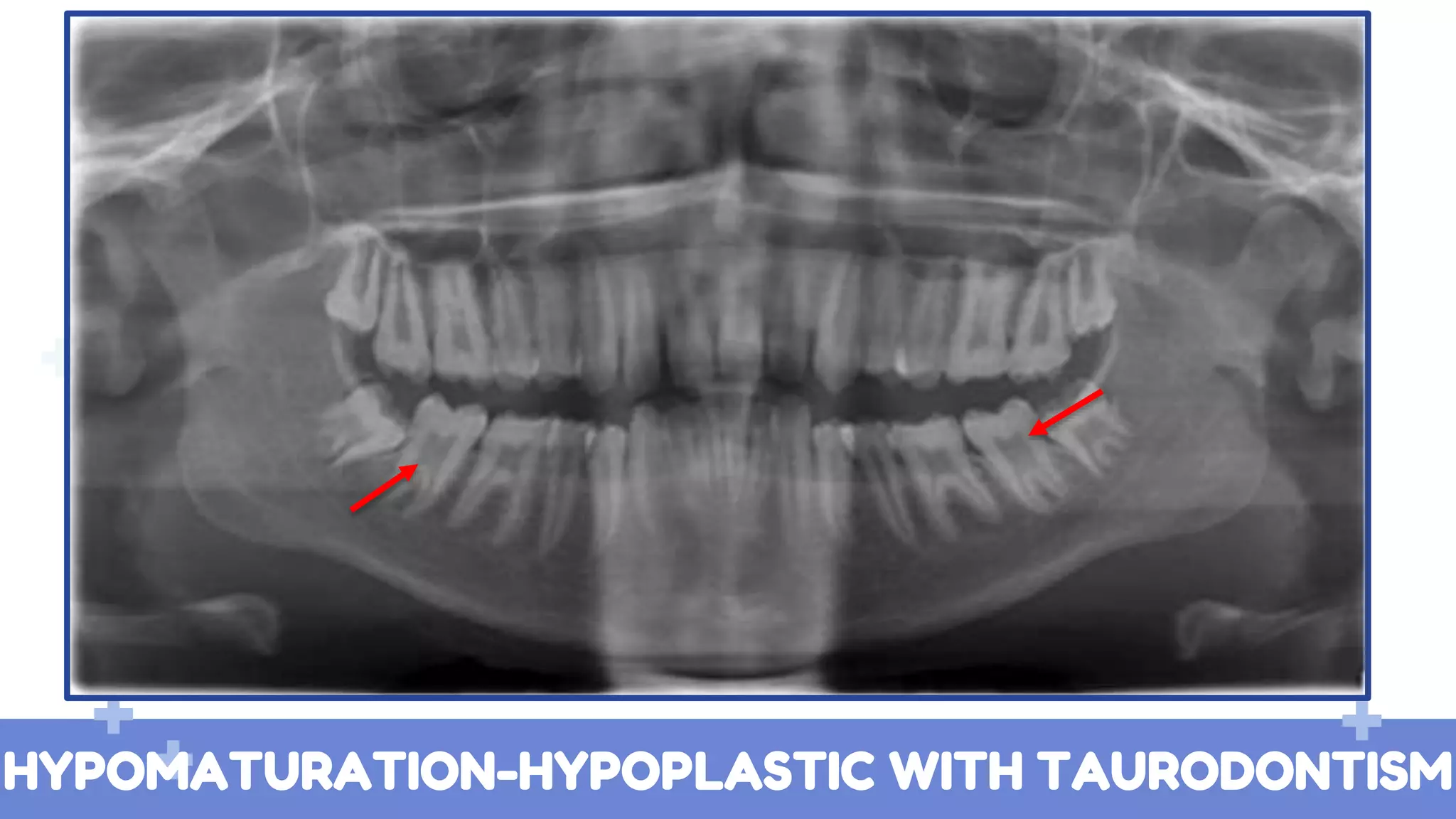 Structural Alterations of tooth.pptx