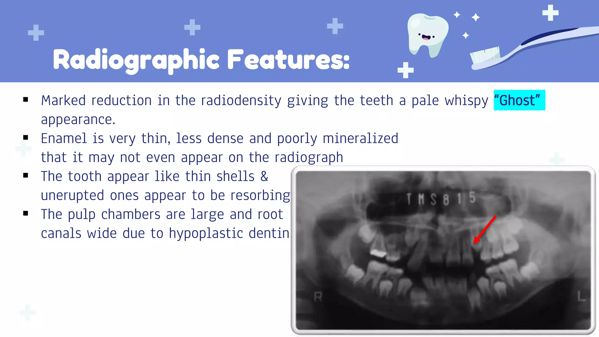 Structural Alterations of tooth.pptx