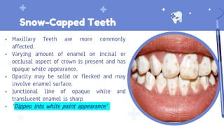 Structural Alterations of tooth.pptx