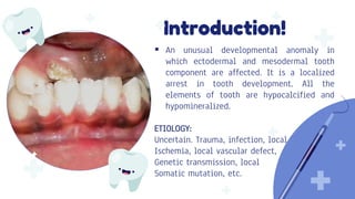 Structural Alterations of tooth.pptx