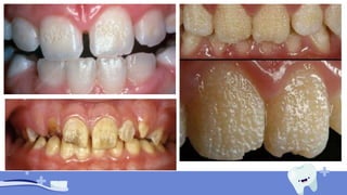Structural Alterations of tooth.pptx