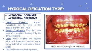 Structural Alterations of tooth.pptx