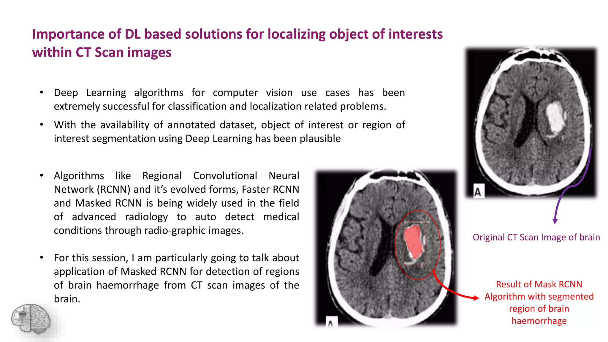 Application of Masked RCNN for segmentation of brain haemorrhage from ...