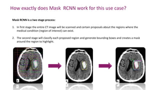 Application of Masked RCNN for segmentation of brain haemorrhage from ...