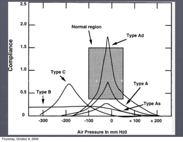 Types of tympanograms - mentorjes