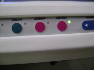 Oec 9600 30 fps | PPT