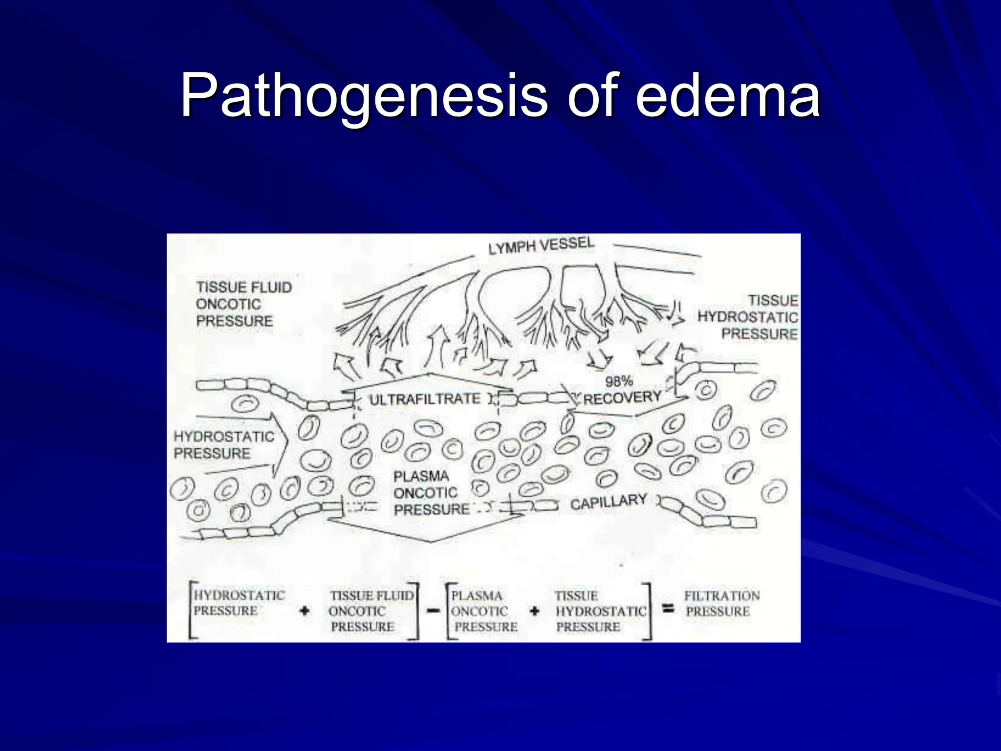 Oedema_edema_Dr_saravjit_singh_pathology.ppt