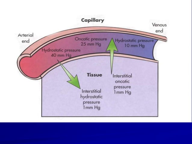 Oedema_edema_Dr_saravjit_singh_pathology.ppt