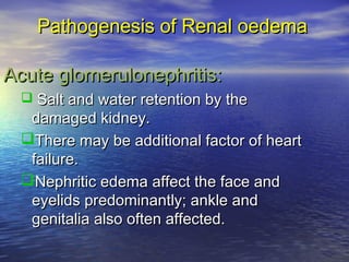 Oedema new edited | PPT