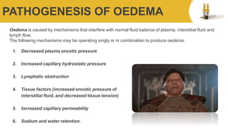 Edema | PPTX