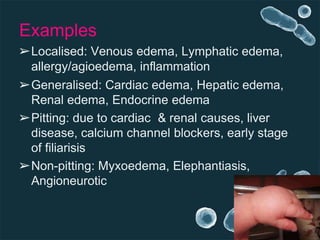 OEDEMA PATHOLOGY (1).pptx