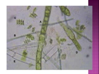 Oedogonium Vegetative Cell