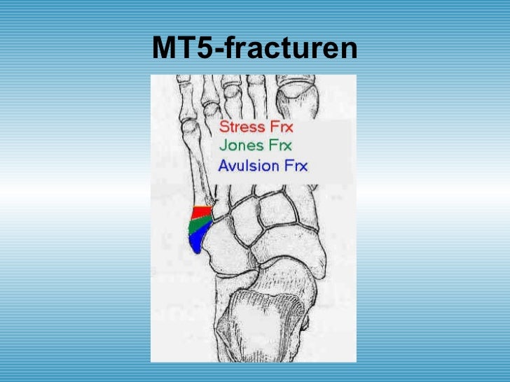 Oefen vgt skelet voorjaar 2008