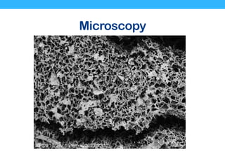 BACTERIAL GENOME SEQUENCING PROJECT | PPT