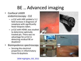 Early Detection and Management of Oesophageal and Gastric Tumours | PPT