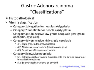 Early Detection and Management of Oesophageal and Gastric Tumours | PPT