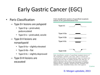 Early Detection and Management of Oesophageal and Gastric Tumours | PPT