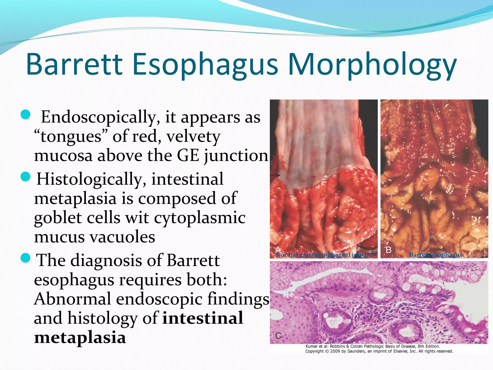 OESOPHAGUS PATHOLOGY | PPT