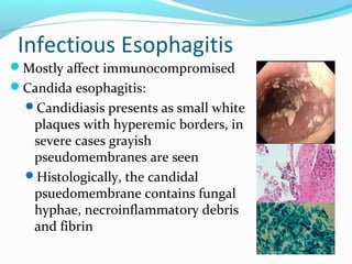 OESOPHAGUS PATHOLOGY | PPT