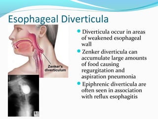 OESOPHAGUS PATHOLOGY | PPT