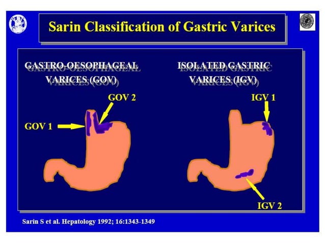 Oesophageal and gastric varices classifications