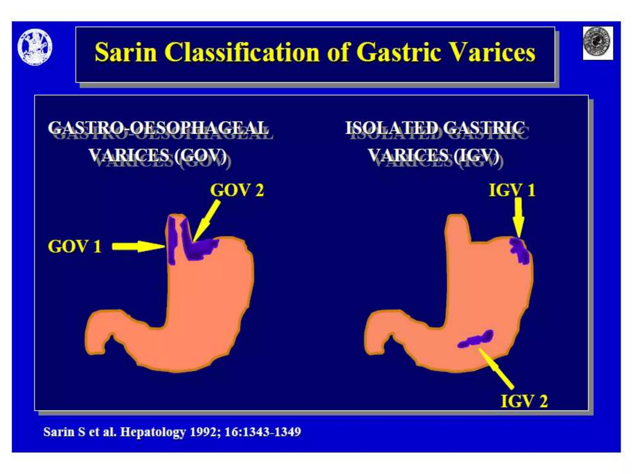 Oesophageal and gastric varices classifications | PPTX