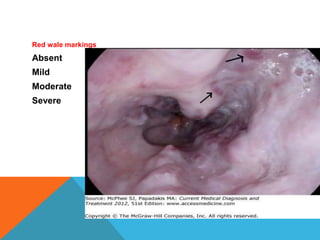 Oesophageal and gastric varices classifications | PPTX