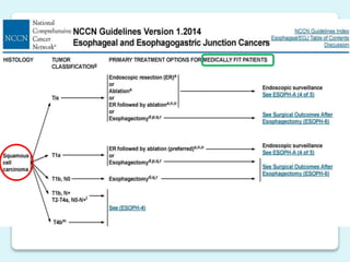 Oesophageal cancer osama | PPTX