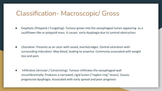 Oesophageal Carcinoma.pdf surgical principles | PDF