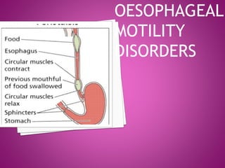 Oesophageal motility disorders | PPT
