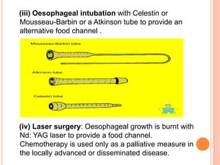 Oesophageal tumors | PPTX