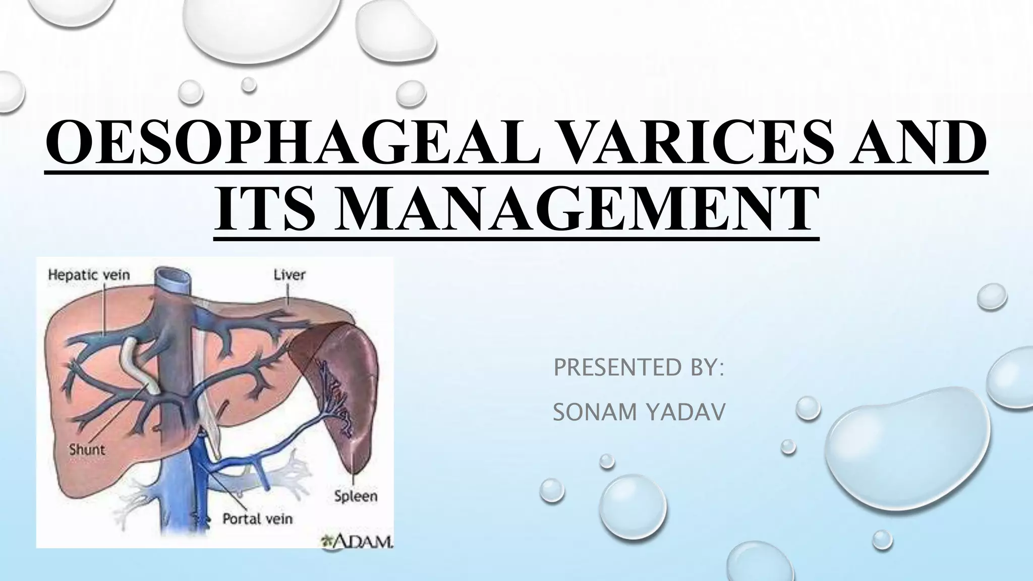 Oesophageal varices ppt slideshare | PPTX