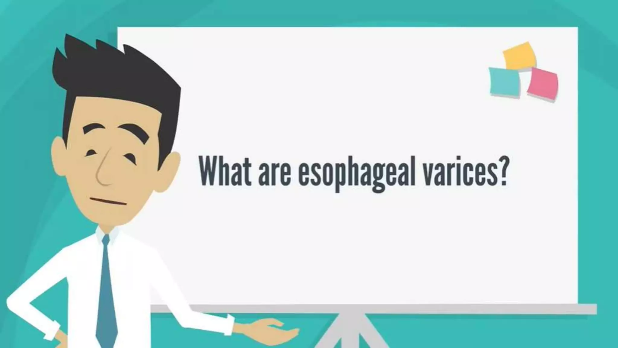 Oesophageal varices ppt slideshare | PPTX
