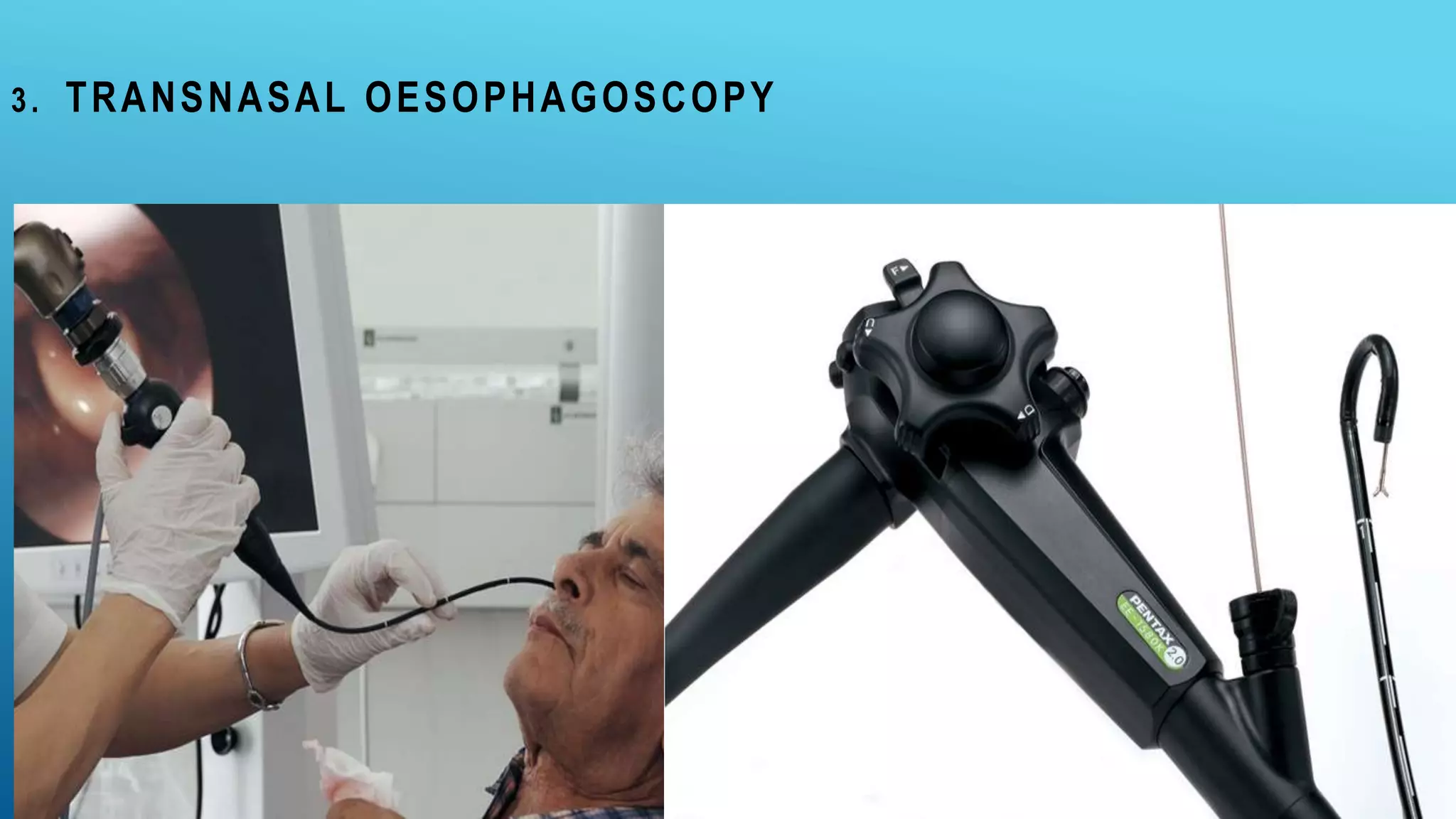 Oesophagoscopy | PPTX
