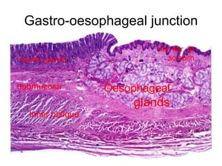 Gastroesophageal Junction Slide Labeled