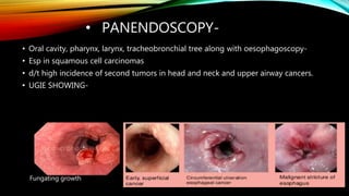Oesophagus | PPTX | Digestive Disorders | Diseases and Conditions
