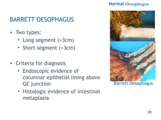 Oesophagus congenital anomalies, motor dysfunction, gerd and tumours 28 ...