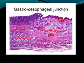Gastroesophageal Junction Slide