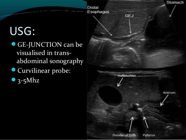 Oesophagus ppt for ss