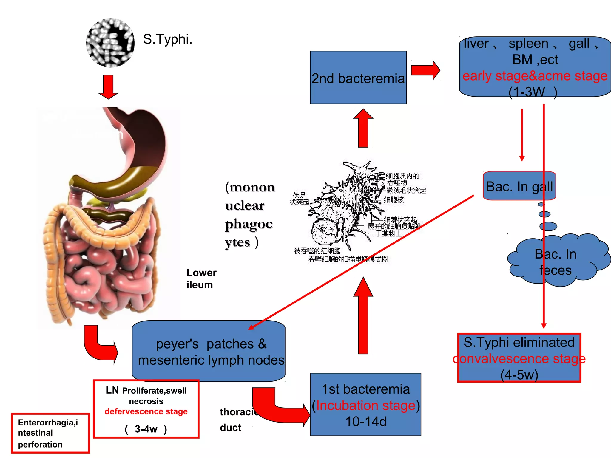 Typhoid neo | PPT