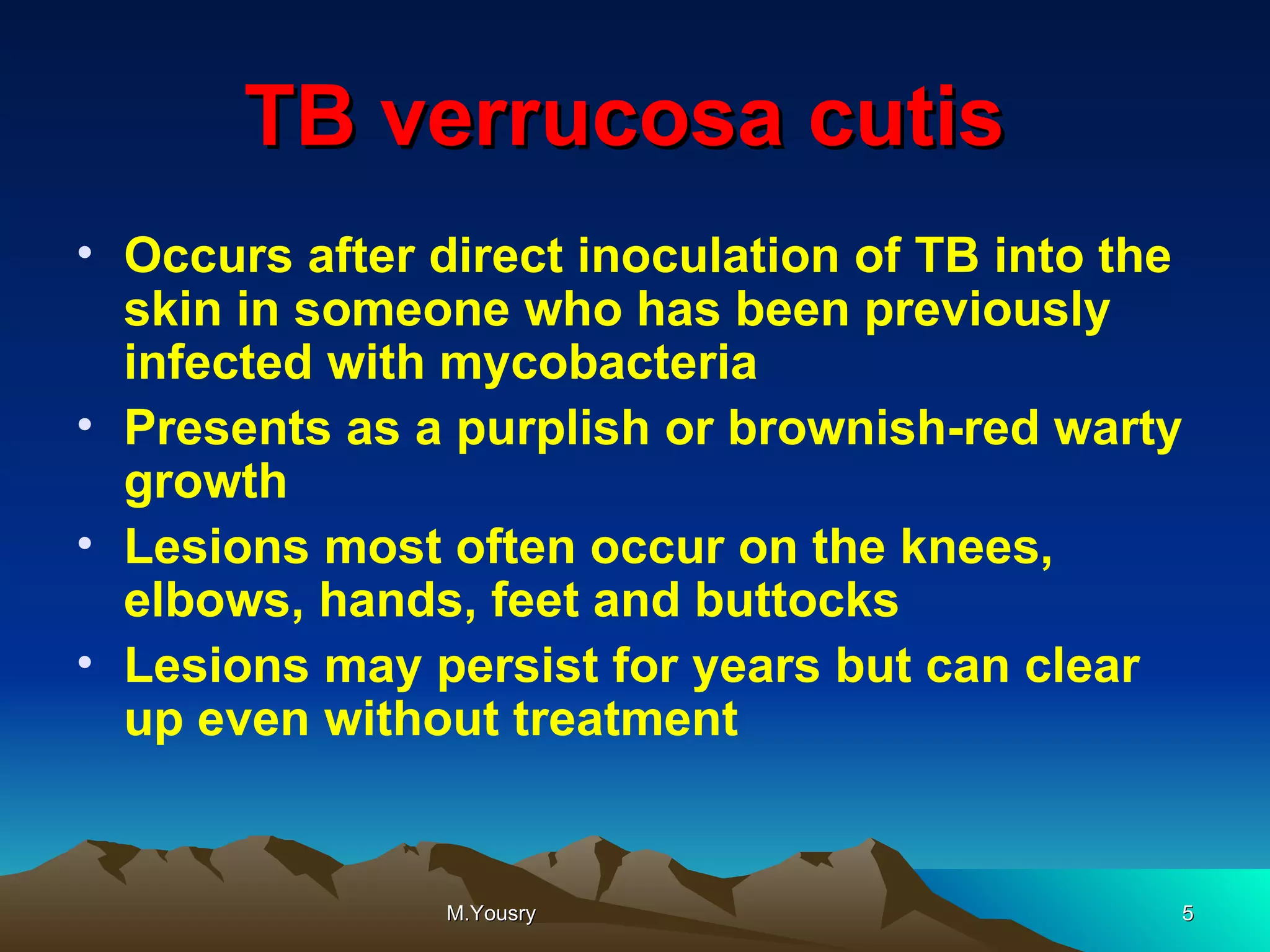 Of Cutaneous T B | PPT