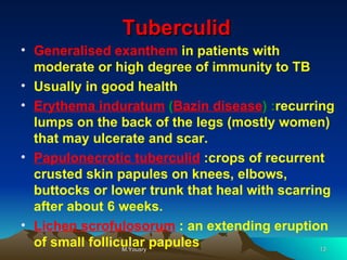 Of Cutaneous T B | PPT
