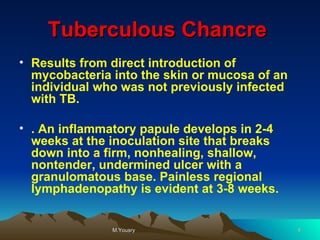 Of Cutaneous T B | PPT